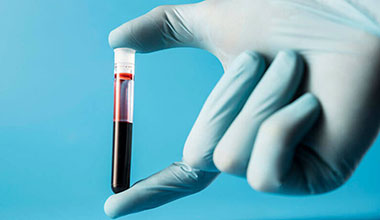 Fresh, Frozen Whole Blood Samples for Research - Solomon Park