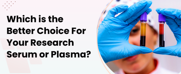 Serum vs. Plasma for Research: Making the Right Choice for Accurate Results