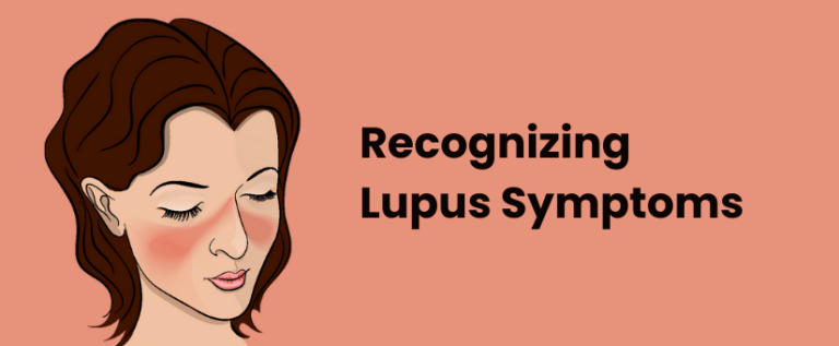 Understanding Lupus: Symptoms, Management, and How You Can Help ...