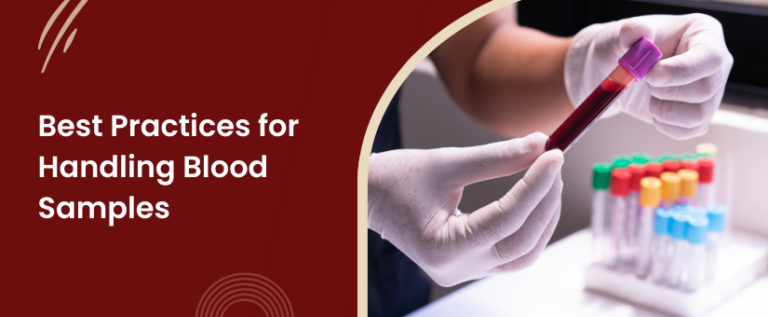 Best Practices for Handling Blood Samples: Ensure Accurate Results
